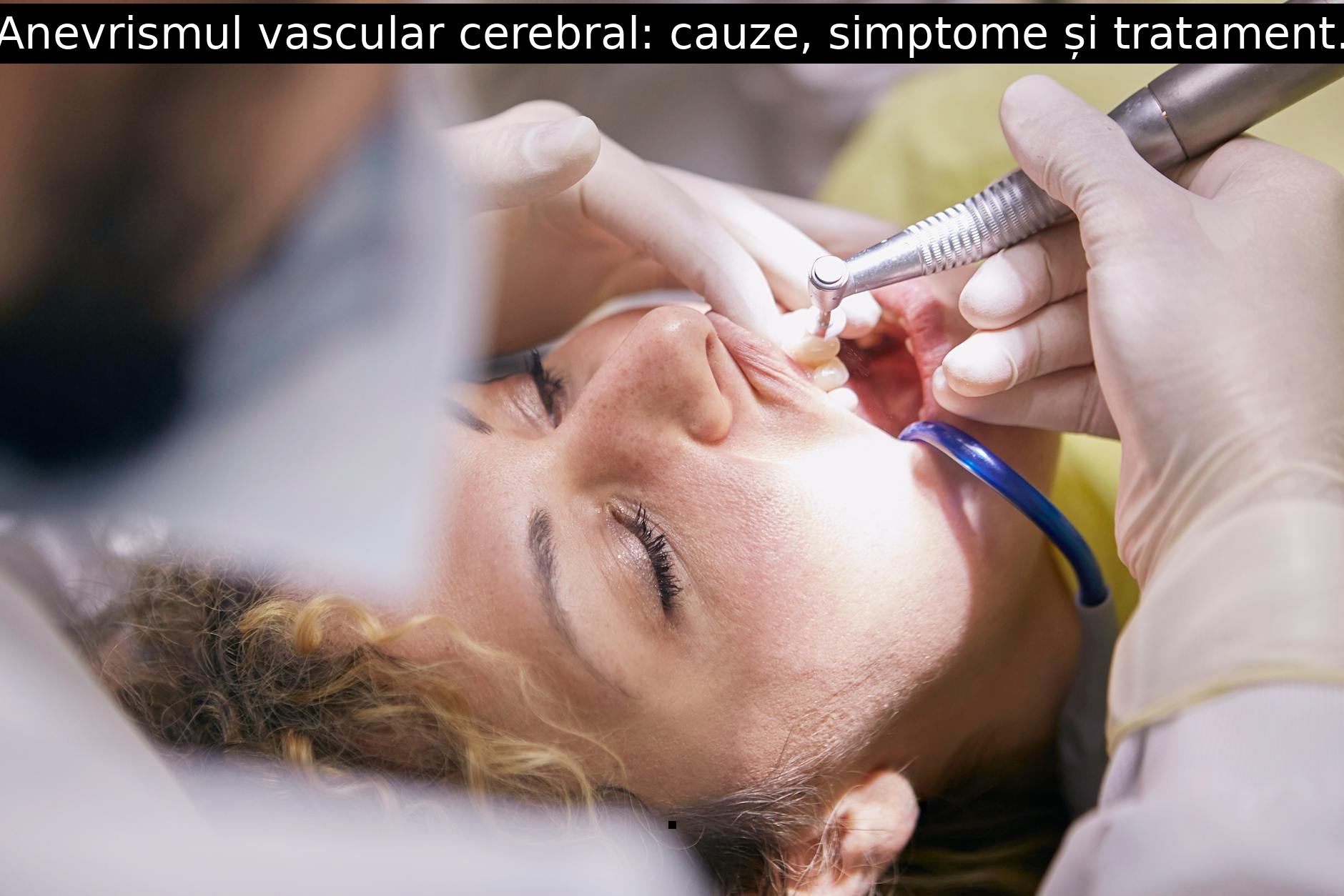 Anevrismul vascular cerebral: cauze, simptome și tratament. - Nutritie ...
